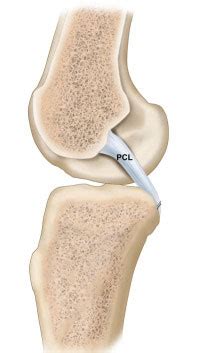 PCL Reconstruction Dr Sarang Patki