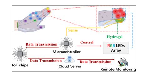 Hydrogel Sensors In An Iot System For Self Monitoring And Remote