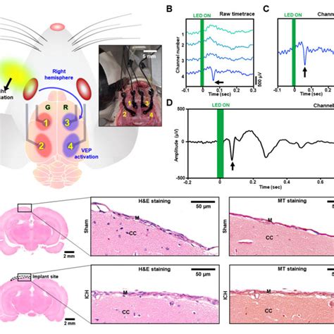 The Material Design Of The Injectable Conductive Hydrogel Ich For