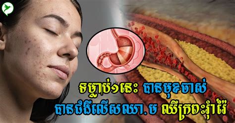 អ្នកគេងមិនគ្រប់រុំារ៉ៃប្រឈមជំងឺច្រើនមុខស្លា ប់មុនអាយុ សម្រស់ក៏ឆាប់ចាស់