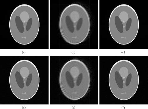 Figure 4 From Correcting Motion Artifacts In Magnetic Resonance Images