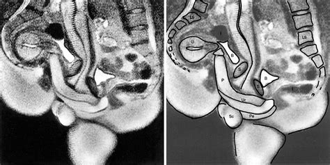 Sexual Intercourse Inside An MRI Machine Gaining Online Virality Decades After It Happened Eyerys
