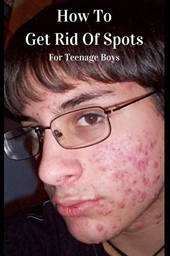 How To Get Rid Of Spots For Teenage Babes By Gavin Sweeney Goodreads
