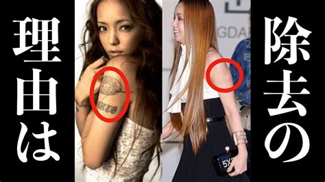 십 년 넘은 타투 지우기로 한 이유