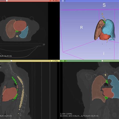 example segmentation from test dataset using convolutional neural