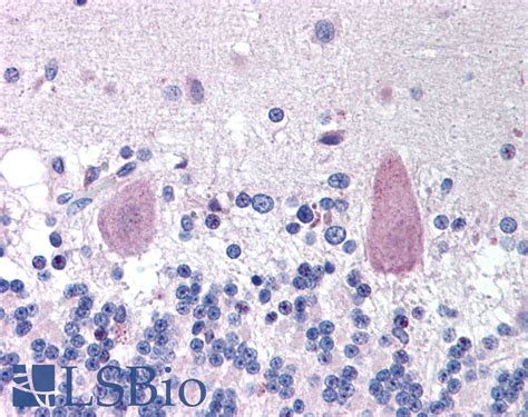 IHC Plus HTT Huntingtin Polyclonal Antibody Rabbit LSBio