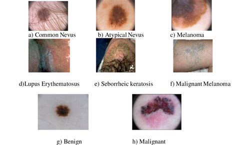 Samples Of Utilized Images In Different Datasets Download Scientific