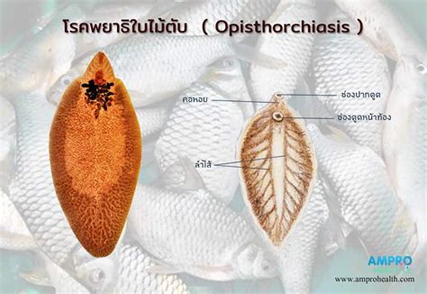 สาเหตุการเกิด โรคพยาธิใบไม้ตับ Opisthorchiasis Am Pro Health