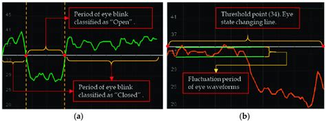 Eye Waveform Representations A Blinking Fluctuation Between Classes Download Scientific