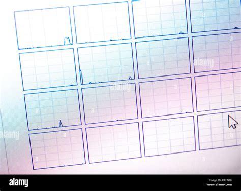 Computer Working With Multiple Cpu Cores Working In Idle Mouse Point In