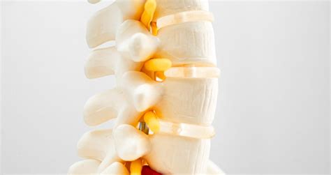 Looking For Spinal Stenosis Treatment In Dallas Read This First