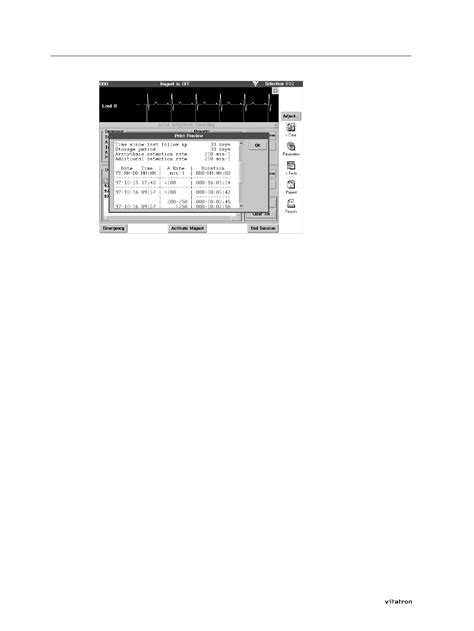 Medtronic 2090 Programming Guide