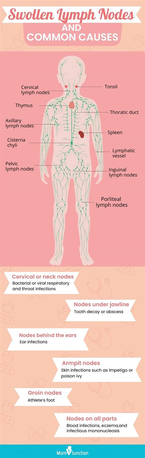 Swollen Lymph Nodes Locations My Xxx Hot Girl