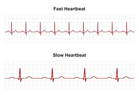 What Does An Abnormal Ecg Mean Capital Heart Centre