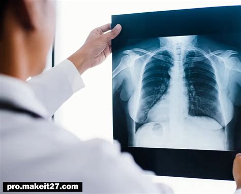 Cxr 의학용어 Psvt 의학용어 Icmp 의학용어 Pro27