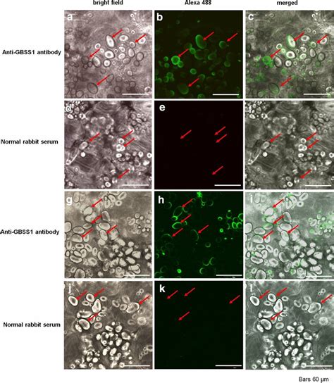 Confocal Immunofluorescence Microscopy Analysis Of Gbss1 Protein A C Download Scientific