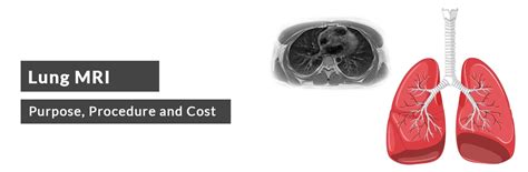 Lung Mri Purpose Procedure Cost And Best Mri Centre In Delhi