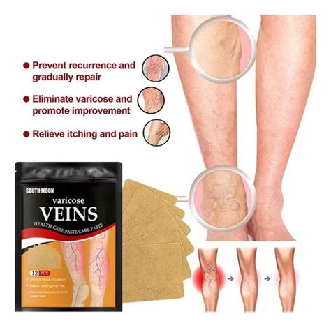 Pack De Parche De Pierna Para Tratamiento Venas Varicosas Cuotas Sin Inter S