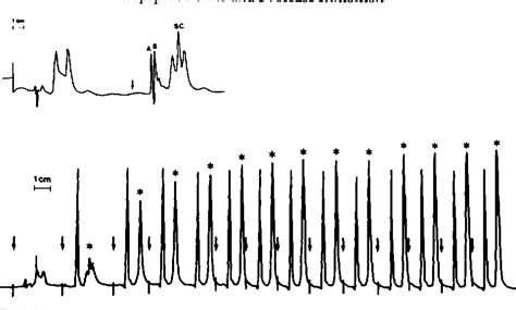 figure 4 from active and inactive forms of the transition state analog