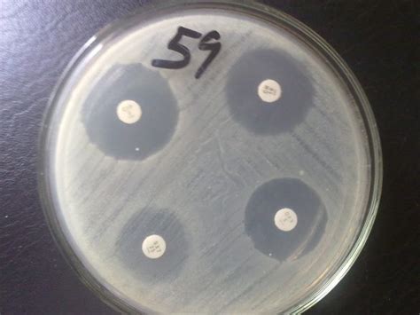 Phenotypic Detection Methods Of Antimicrobial Resistance Amr In Pathogenic Bacteria