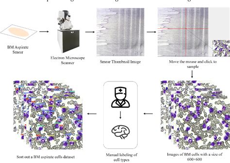 Figure 1 From Improved YOLOv7 Algorithm For Detecting Bone Marrow Cells