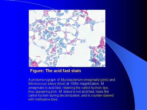 Microscope Microscope The Simple Stain L In A