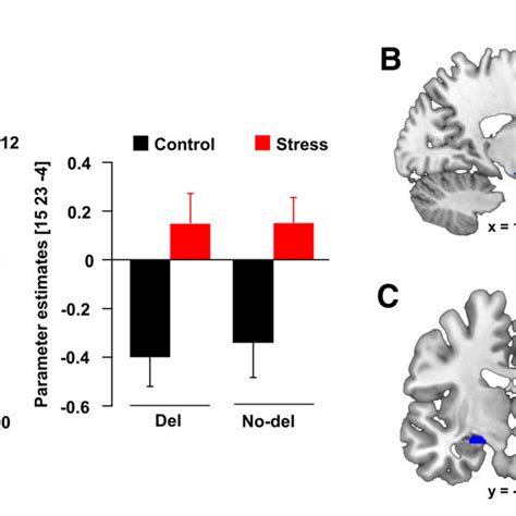 Stress Effects On Brain Activity And Connectivity A The Right Caudate Download Scientific