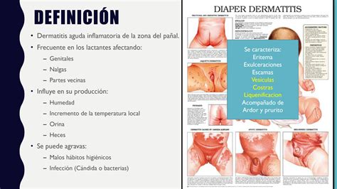 Solution Dermatitis De La Zona Del Pa Al Cesar Rafael Salgado Aleman