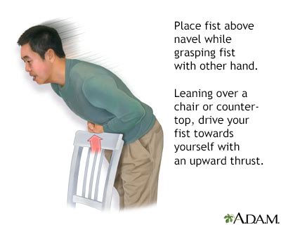 Heimlich Maneuver On Self Uf Health