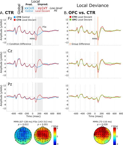 Altered Hierarchical Auditory Predictive Processing After Lesions To The Orbitofrontal Cortex