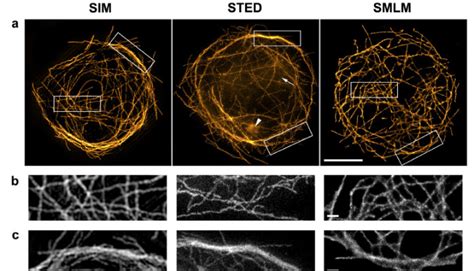 Imaging Cellular Structures In Super Resolution With Sim Sted And
