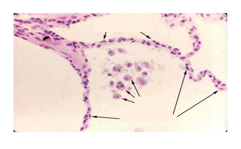 Simple Squamous Epithelium Location And Function Quizlet At Cristal