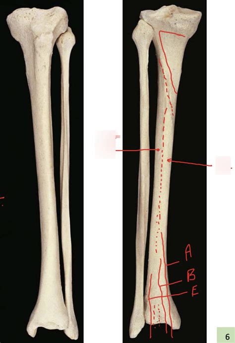 TIBIA POSTERIOR SURFACE Diagram Quizlet