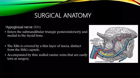Submandibular Gland Excision Pptx