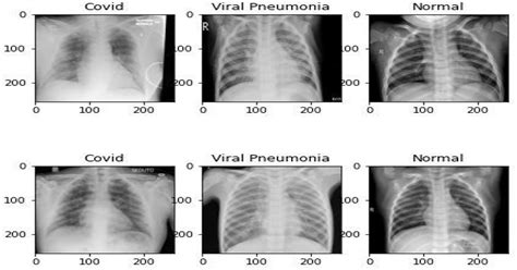 Frontiers A Deep Transfer Learning Approach For Covid 19 Detection