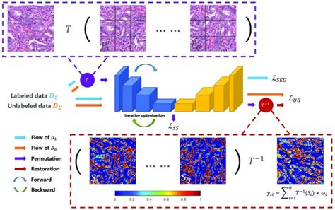 Self Loop Uncertainty A Novel Pseudo Label For Semi Supervised Medical Image Segmentation DeepAI