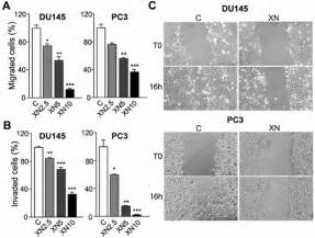 Xn Treatment Inhibits Pca Cell Migration And Invasion Migration A