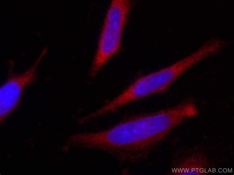 Ikb Alpha Antibody Cl647 10268 Proteintech