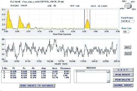 Display Panel Showing Heart Rate Variability In A Control Subject Download Scientific Diagram