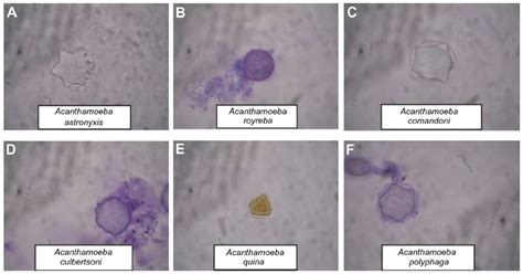 Occurrence Of Acanthamoeba Species In The Damanhour Drinking Water Tre Rip