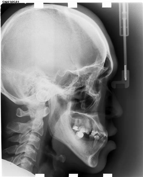 Bardia Bardia 3mkbz Roboflow Universe