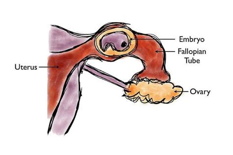 The Fallopian Tubes Uterine Structure Function Vascular Supply