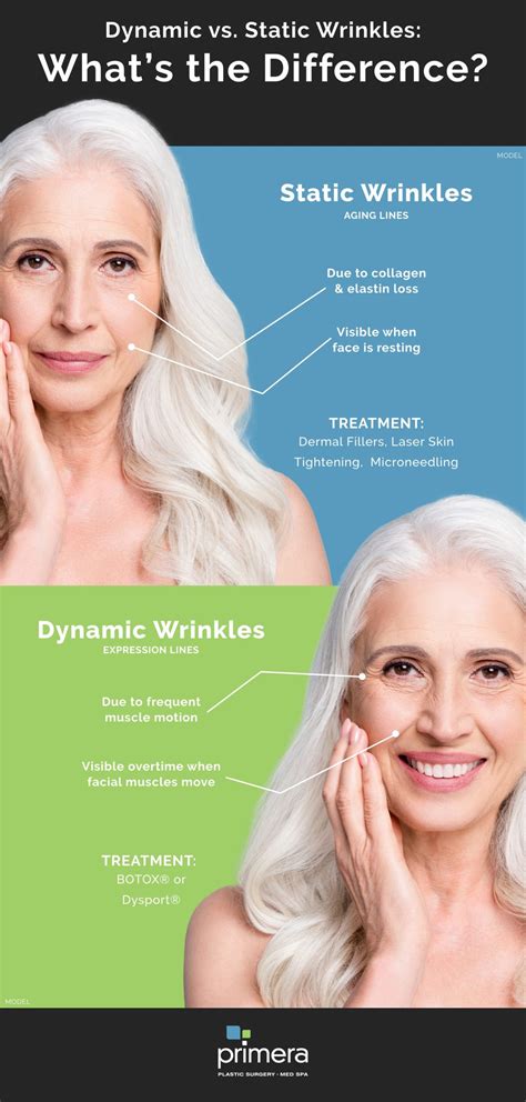Dynamic Vs Static Wrinkles Whats The Difference INFOGRAPHIC