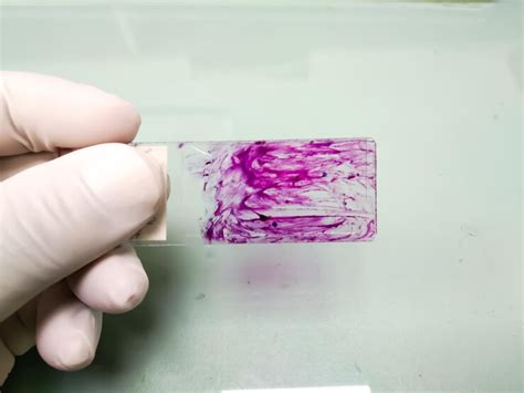 Premium Photo Stained Histology Slide Which Is Ready For Microscopic Examination Cytology