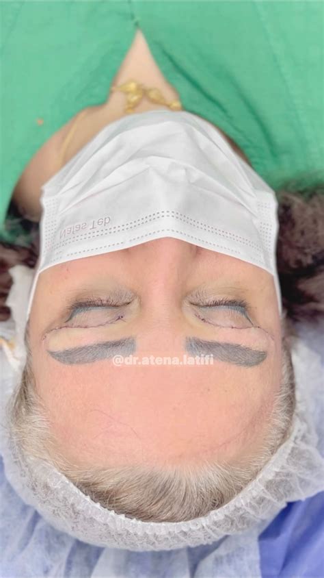 ‎دکتر آتنا لطیفی‎ ‎با ما از ظریفی بخیه ها صحبت کنید چی از این بهتر