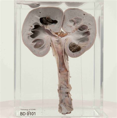 第1章 细胞、组织的适应和损伤