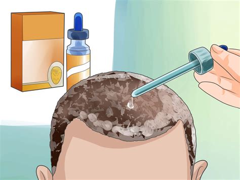 Ways To Hide Baldness WikiHow