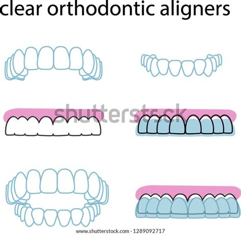 Clear Aligners Vector Stock Vector Royalty Free 1289092717 Shutterstock