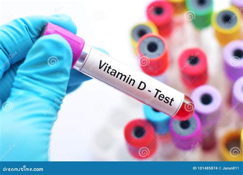 Vitamin D Test Stock Photo Image Of Chemistry Health 101485874