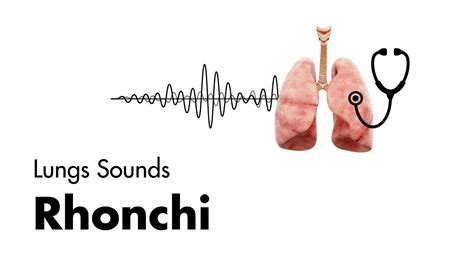 Rhonchi Lung Sounds Medzcool Youtube